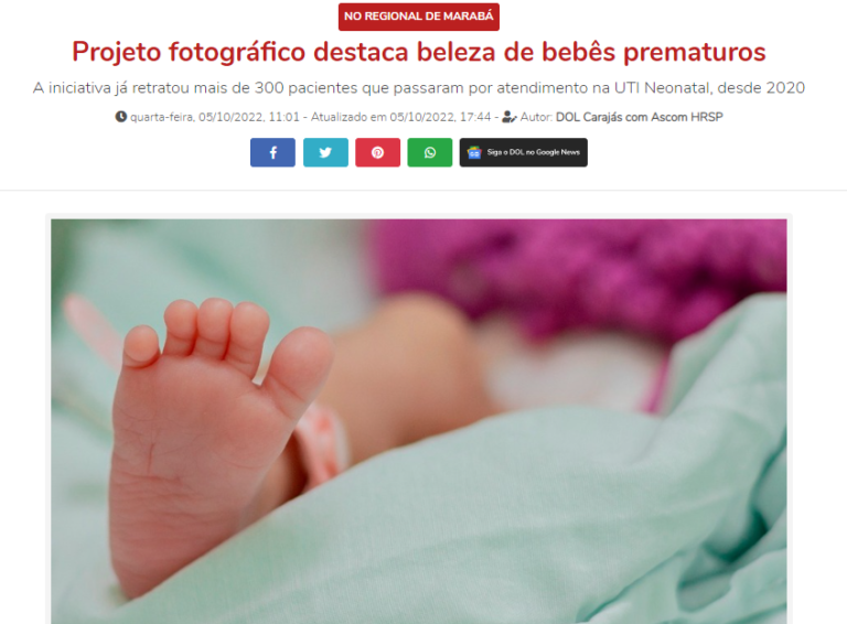 DOL - Projeto fotográfico destaca beleza de bebês prematuros - Pró-Saúde